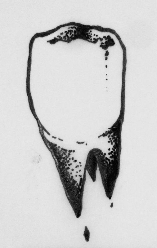 Rotten Tooth by Ben Licata: TattooNOW